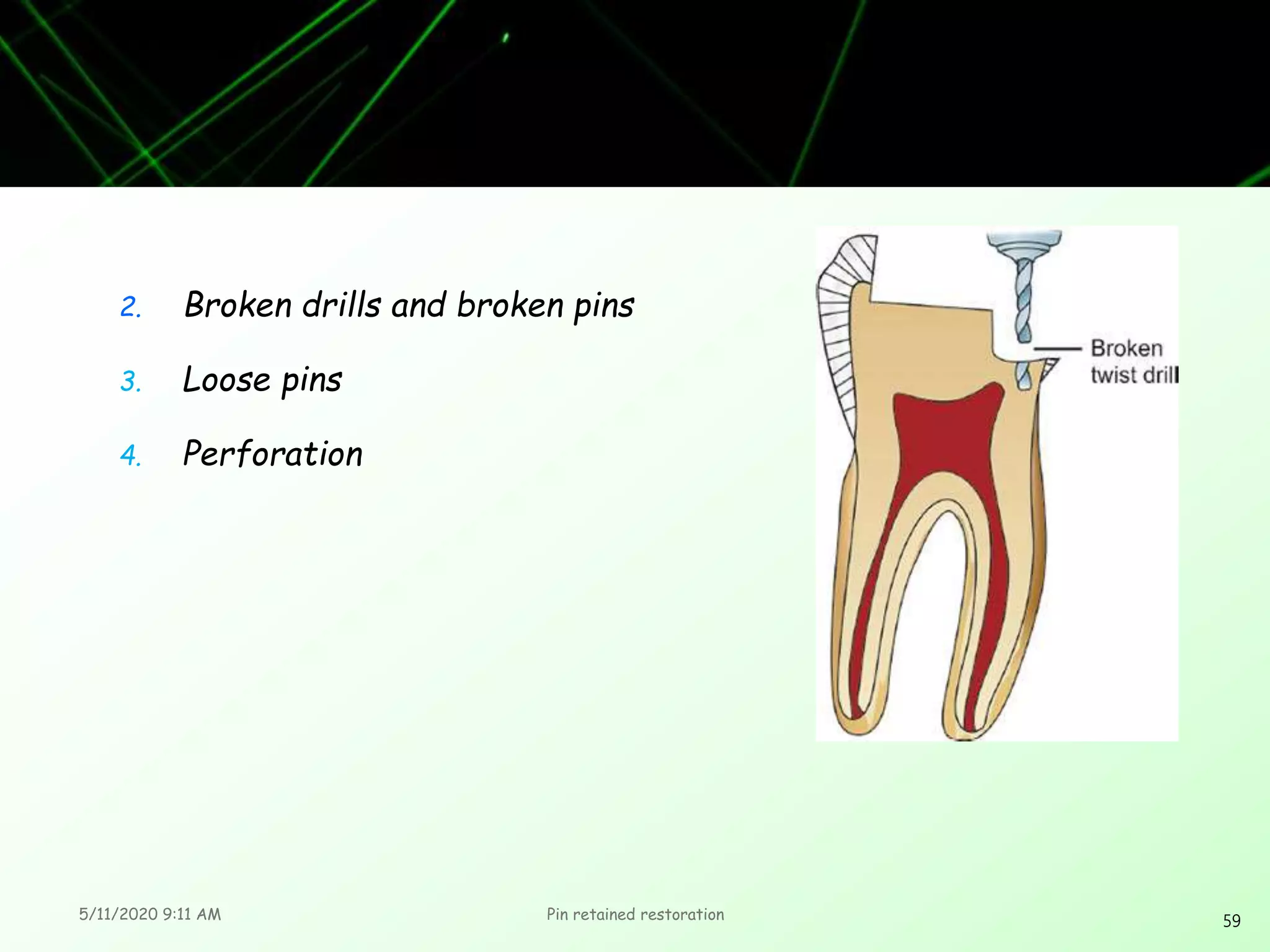 Pin retained restorations | PPTX