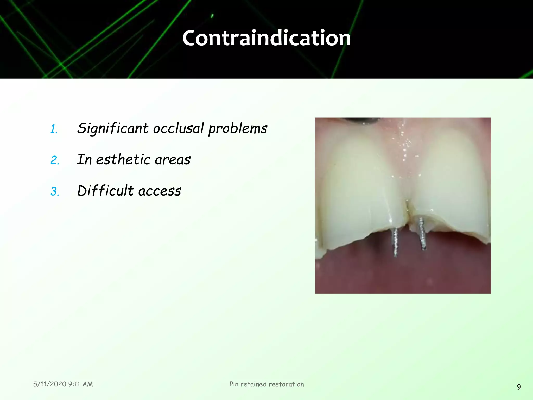 Pin retained restorations | PPTX