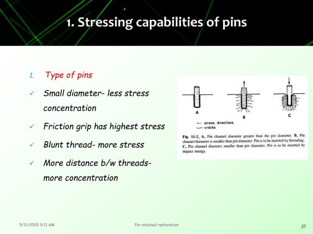 Pin retained restorations | PPTX