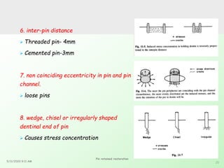 Pin retained restorations | PPTX