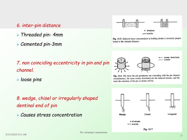 Pin retained restorations | PPTX
