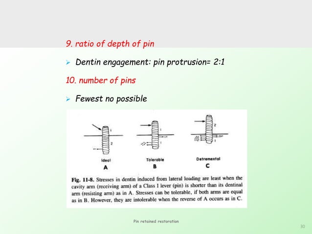 Pin retained restorations | PPTX