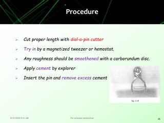 Pin retained restorations | PPTX