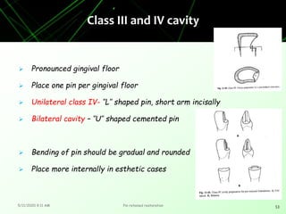 Pin retained restorations | PPTX