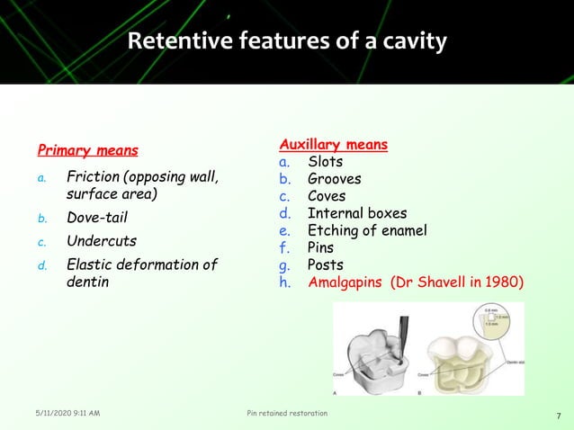 Pin retained restorations | PPTX