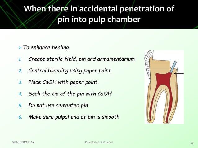 Pin retained restorations