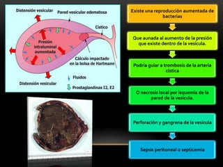 Piocolecisto | PPTX