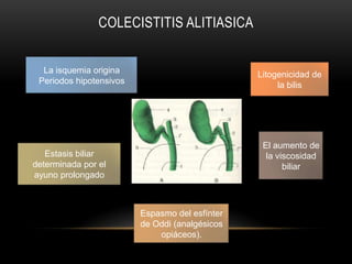 Piocolecisto | PPTX