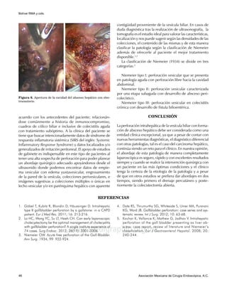 Piocolecisto | PDF