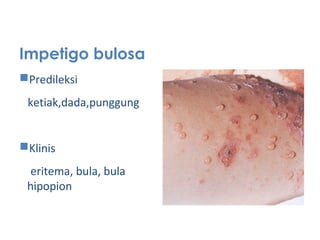 Pioderma - Infeksi Kulit | PPT