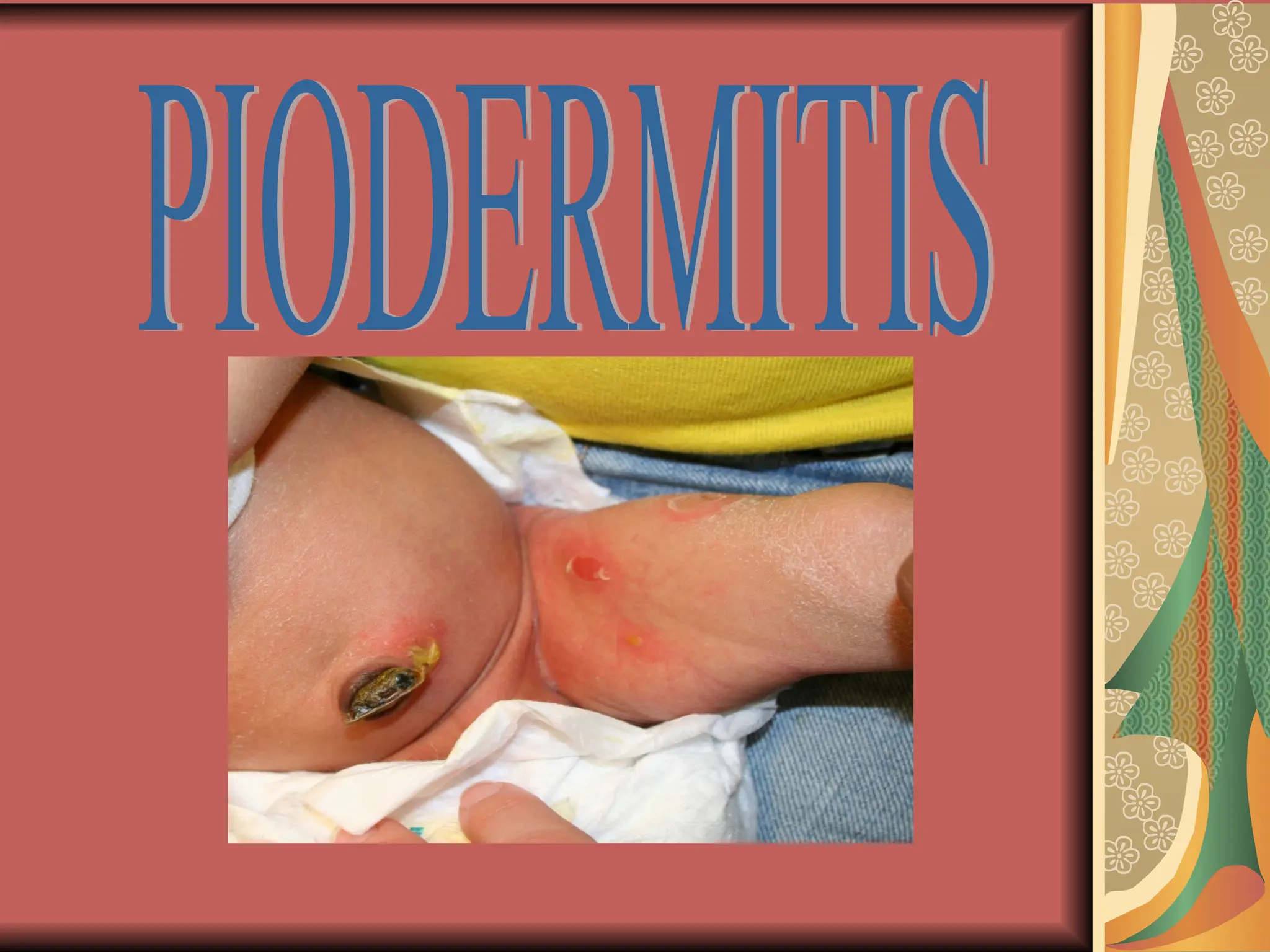 Piodermitis.ppt power point gratis med ppt | PPT