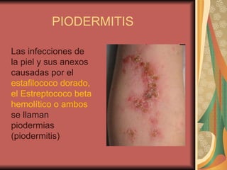 Piodermitis.ppt power point gratis med ppt | PPT