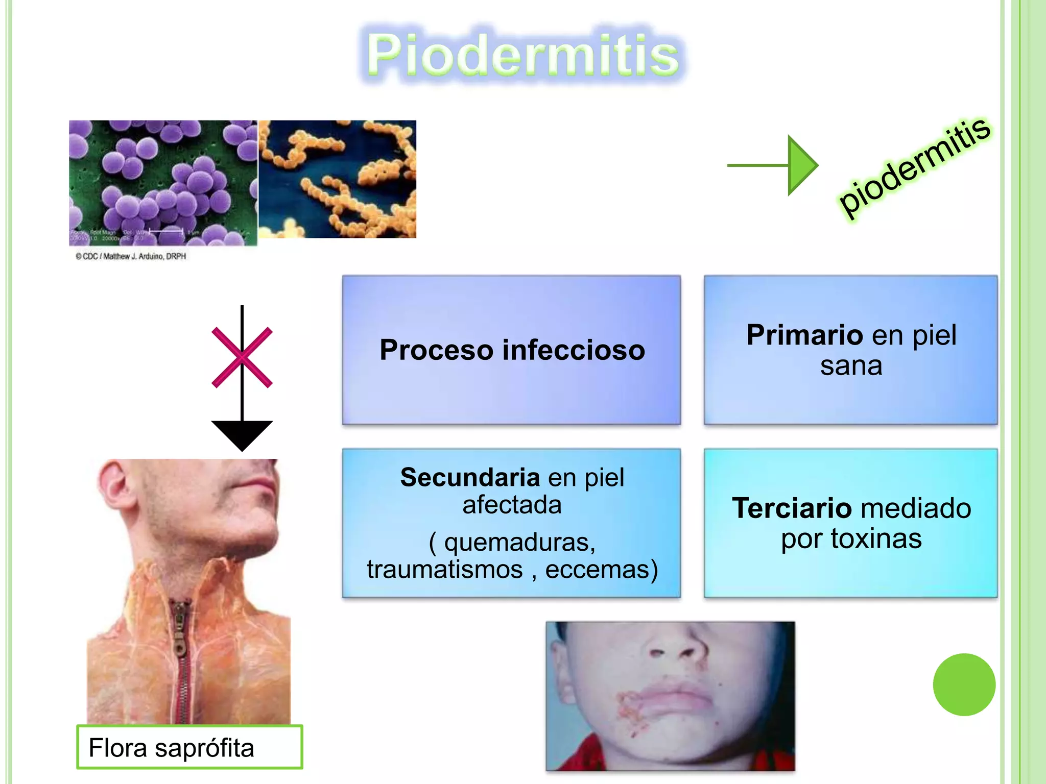 Piodermitis completo | PPT