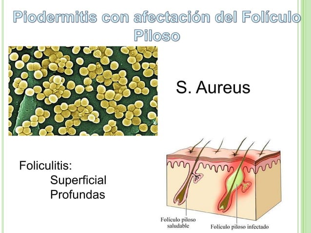 Piodermitis completo | PPTX