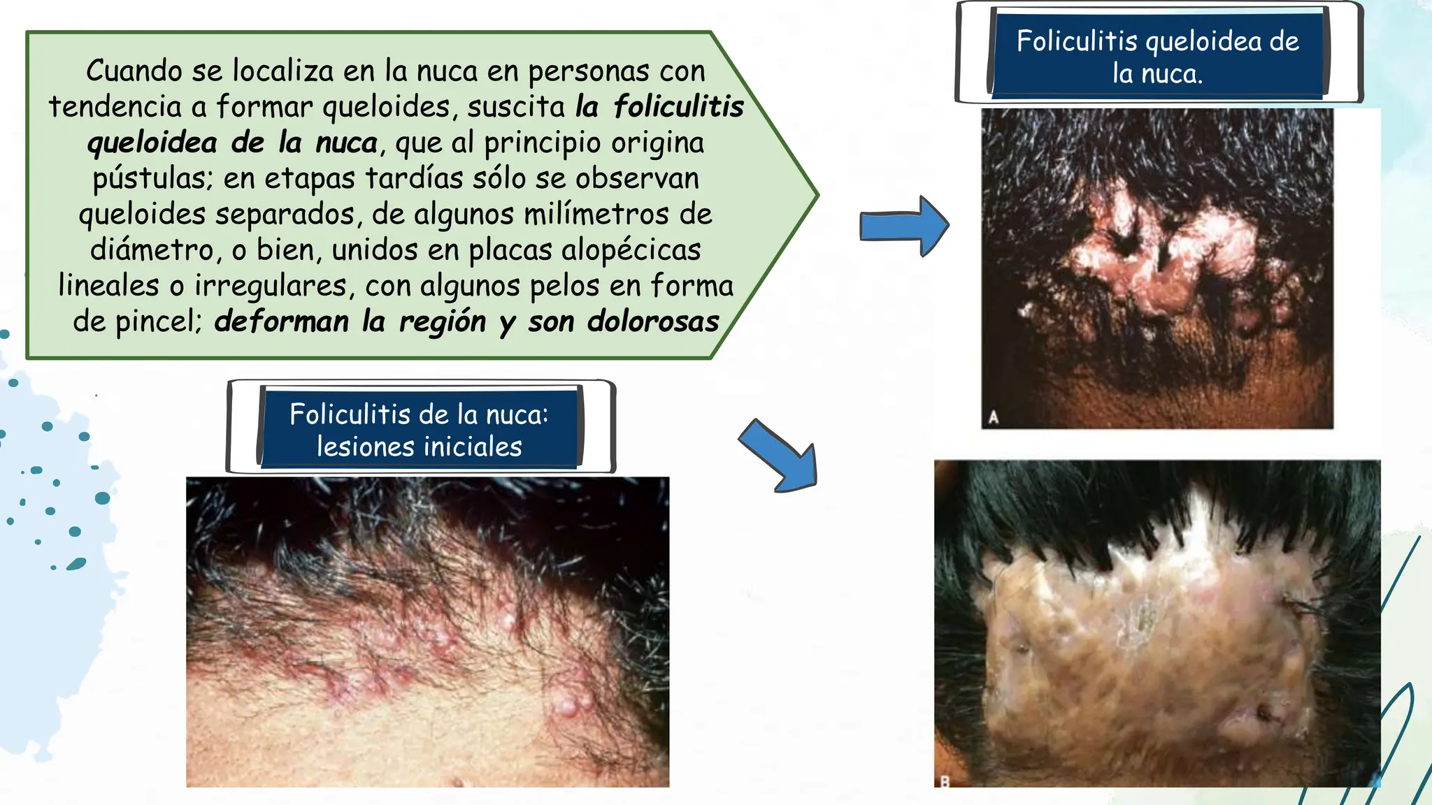 PIODERMITIS DERMATOLOGIA INFECTOLOGIA.INFECTOLOGIA | PPTX