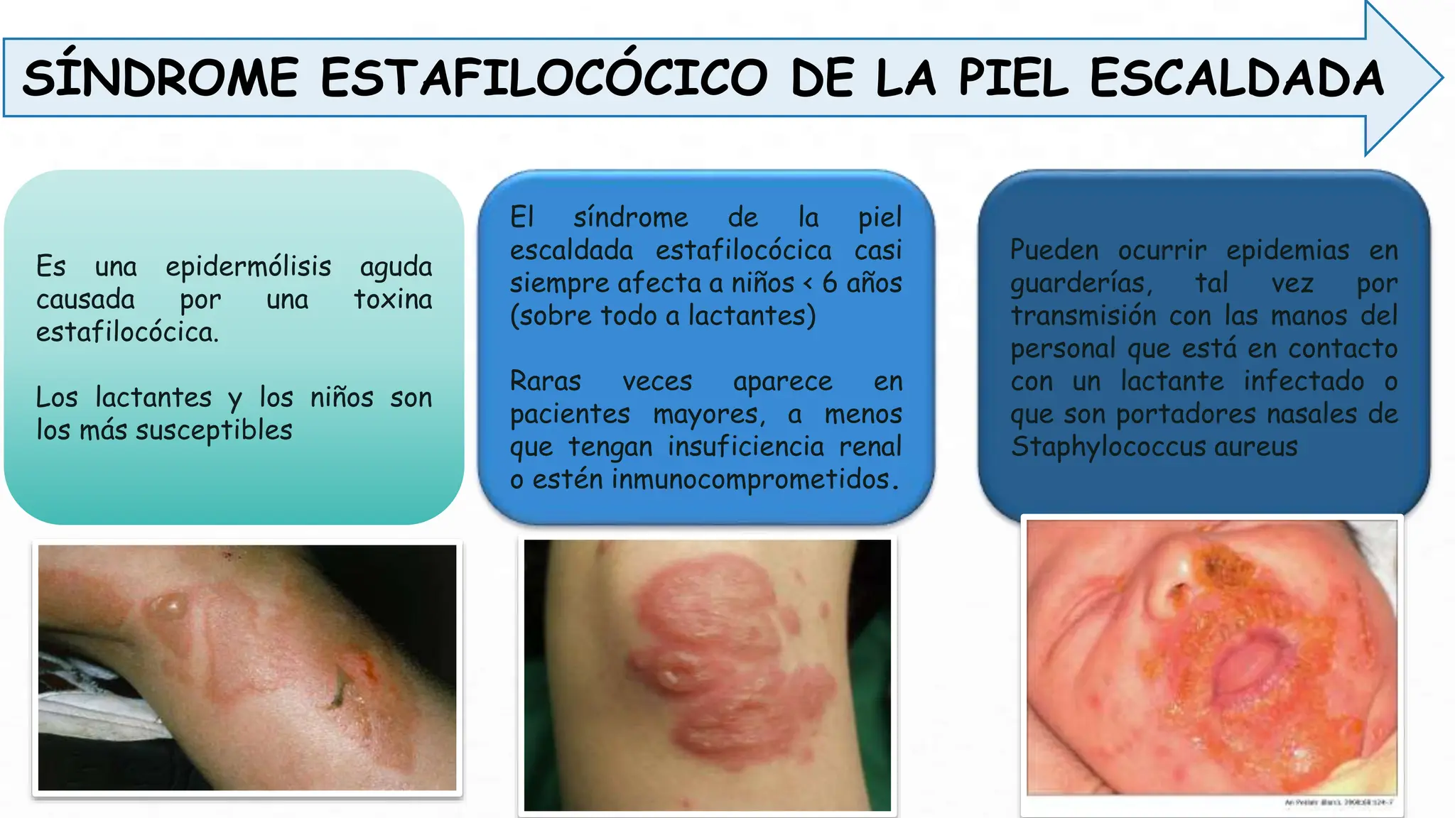PIODERMITIS DERMATOLOGIA INFECTOLOGIA.INFECTOLOGIA | PPTX