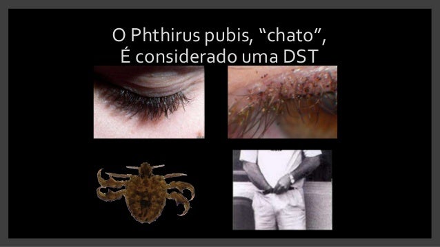 Escabiose e Pediculose