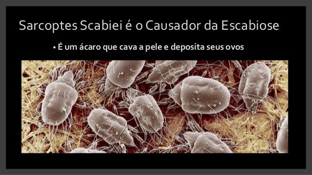Escabiose e Pediculose