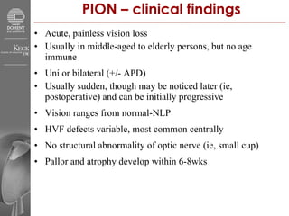 An Unusual Case of Posterior Ischemic Optic Neuropathy | PPT