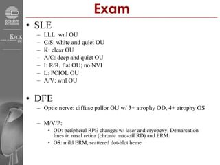 An Unusual Case of Posterior Ischemic Optic Neuropathy | PPT