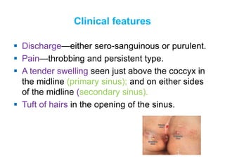 Pionidal sinus | PPT