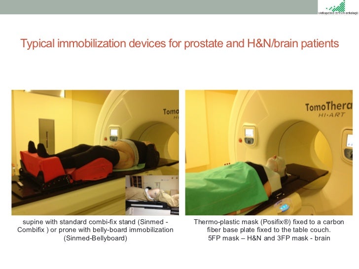 Tomotherapy:3 years experience