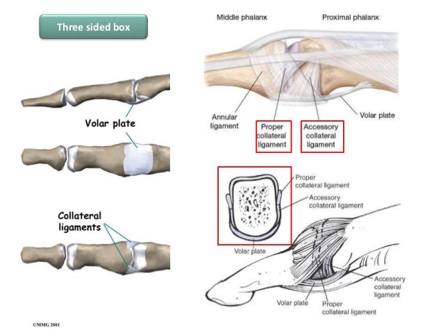 PIP joint approach