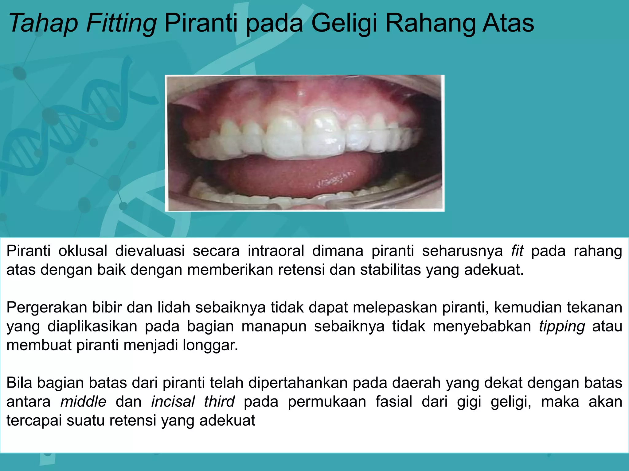 PIRANTI OKLUSAL.pptx