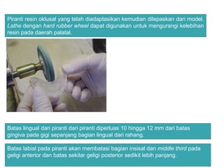 PIRANTI OKLUSAL.pptx