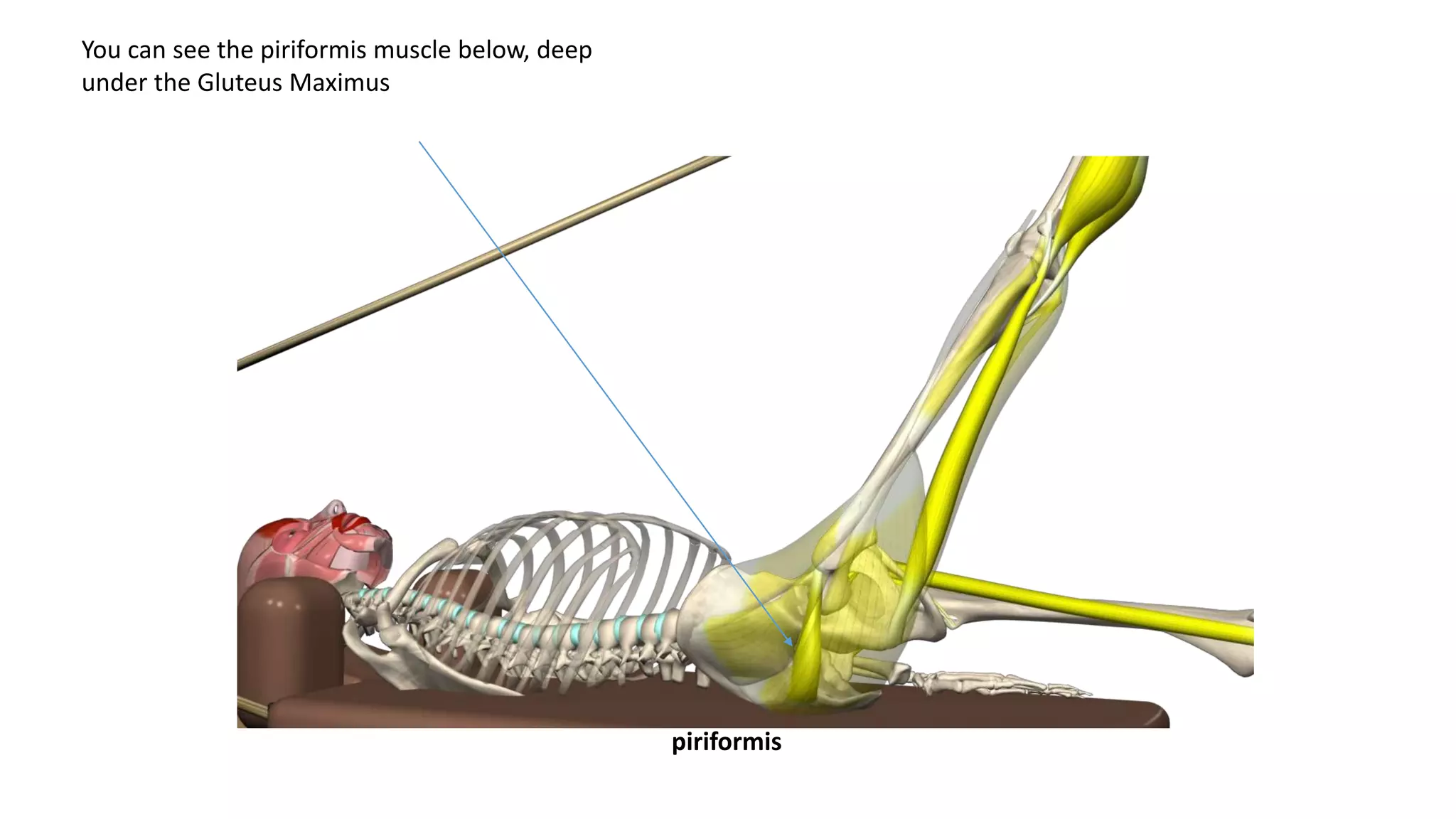 Piriformis sydrome and Pilates | PPTX