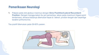 Referat / Pengayaan Piriformis syndrome | PPTX