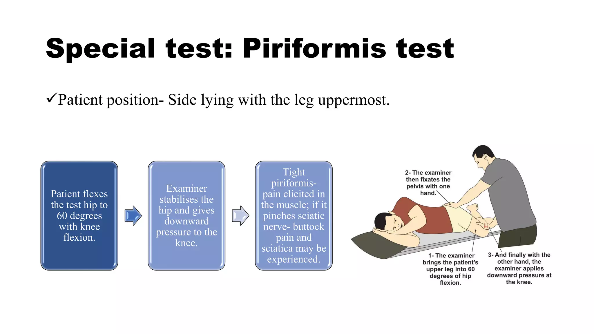 Piriformis Syndrome.pdf