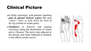 Piriformis Syndrome.pdf