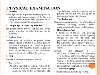 PIRIFORMIS SYNDROME P0wer point presentation | PPTX