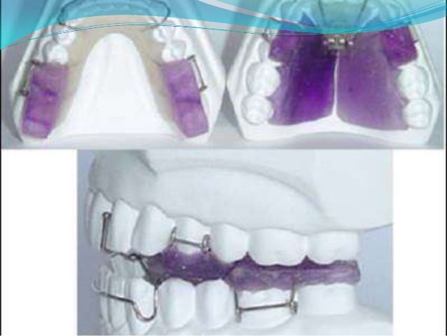 Pistas planas andrea