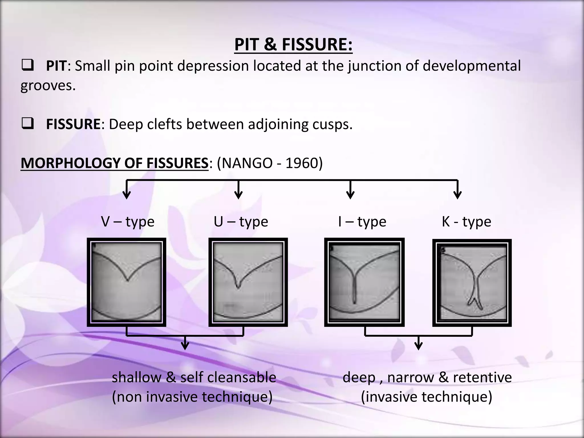 Pit and fissure | PPTX