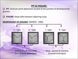 Pit and fissure | PPT