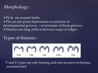 Pit and fissures | PPTX