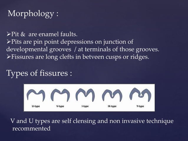 Pit and fissures | PPTX