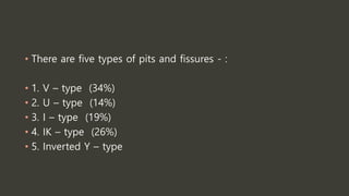 Pit and fissures Sealants | PPTX