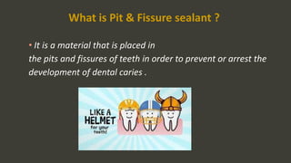 Pit and fissures Sealants | PPTX