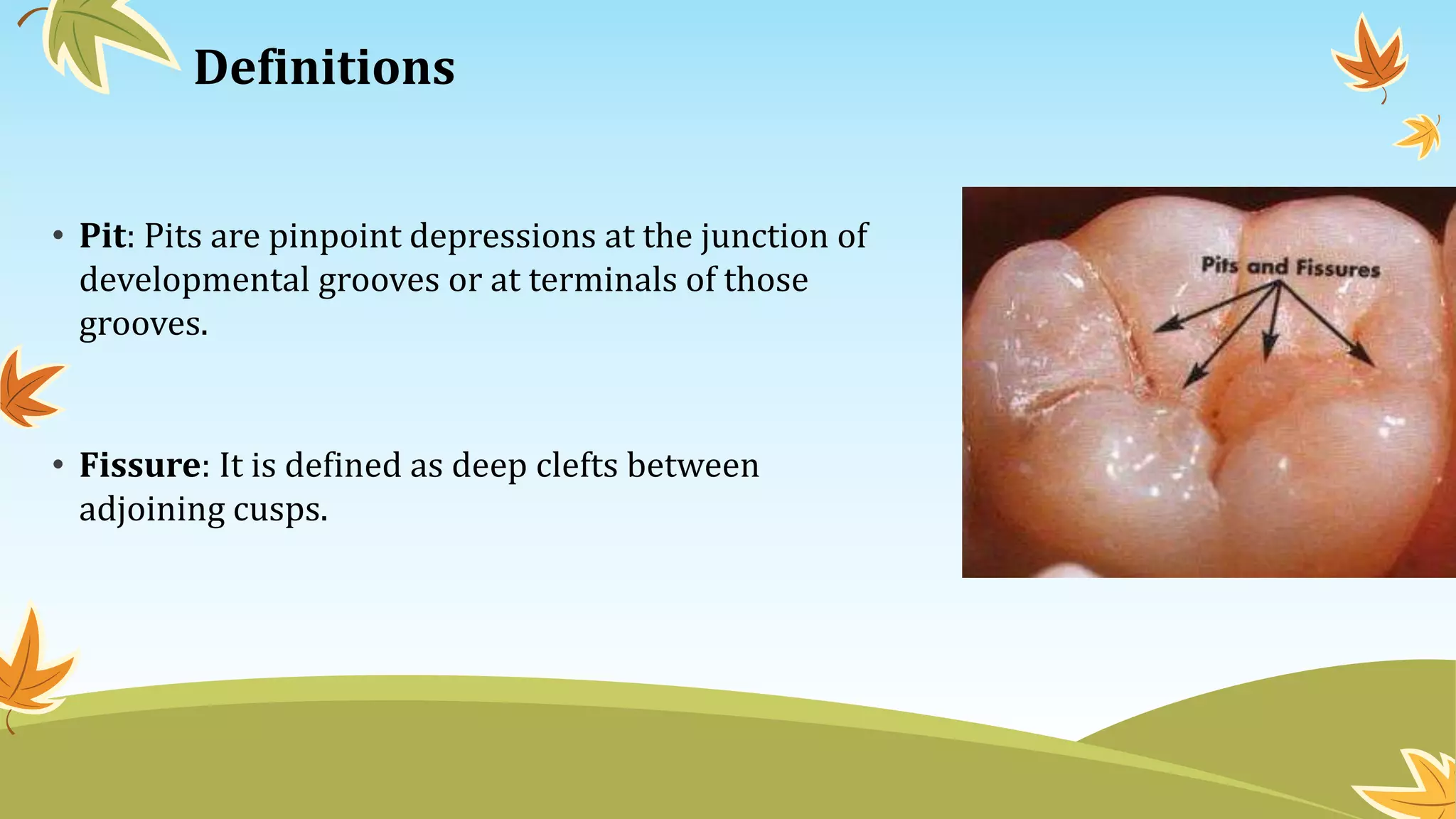 Pit and fissure sealant | PPTX