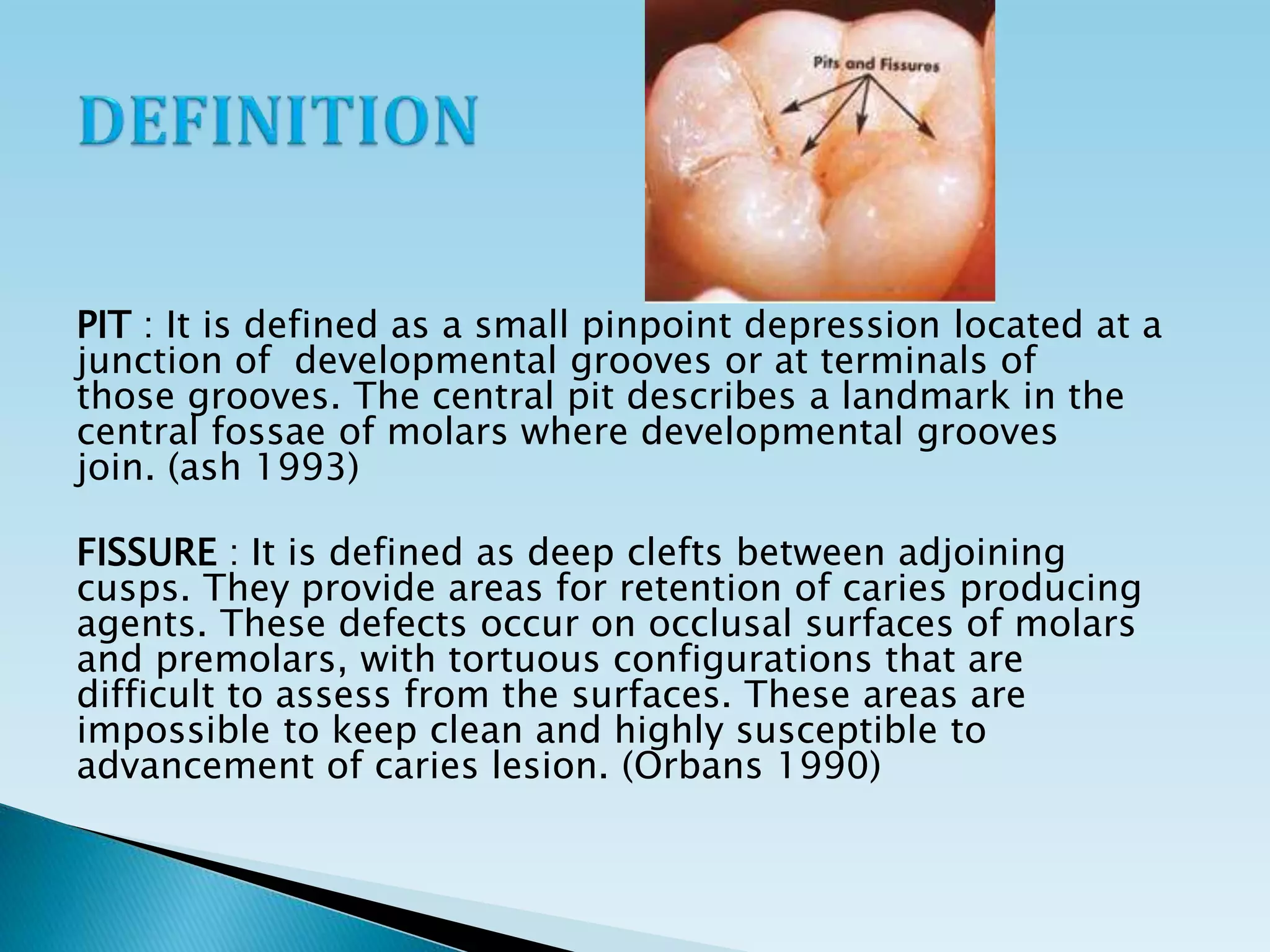 Pit and Fissure sealants | PPTX