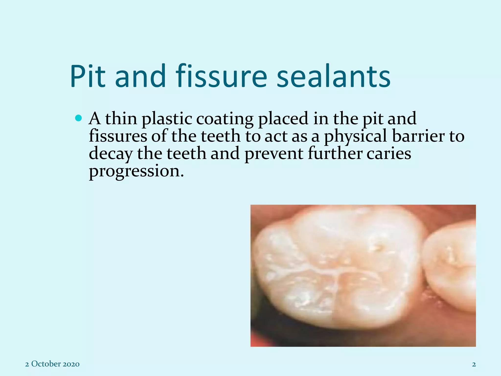 Pit and fissure sealant | PPTX