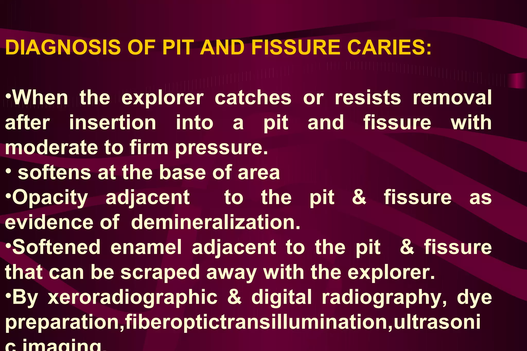 Pit and fissure sealants | PPT