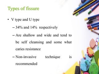 Pit and fissure sealants | PPTX