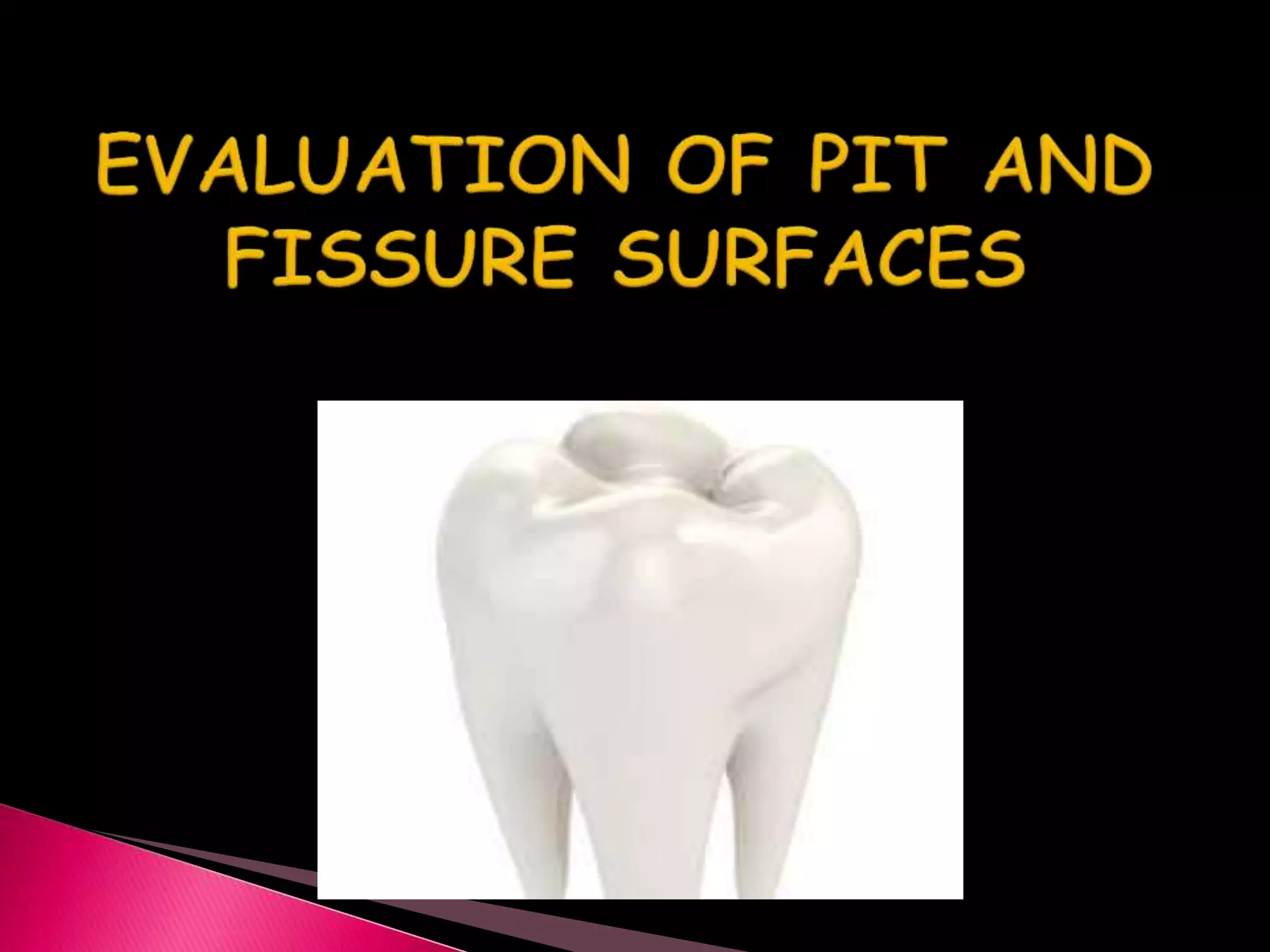 Pit and fissure sealants | PPTX