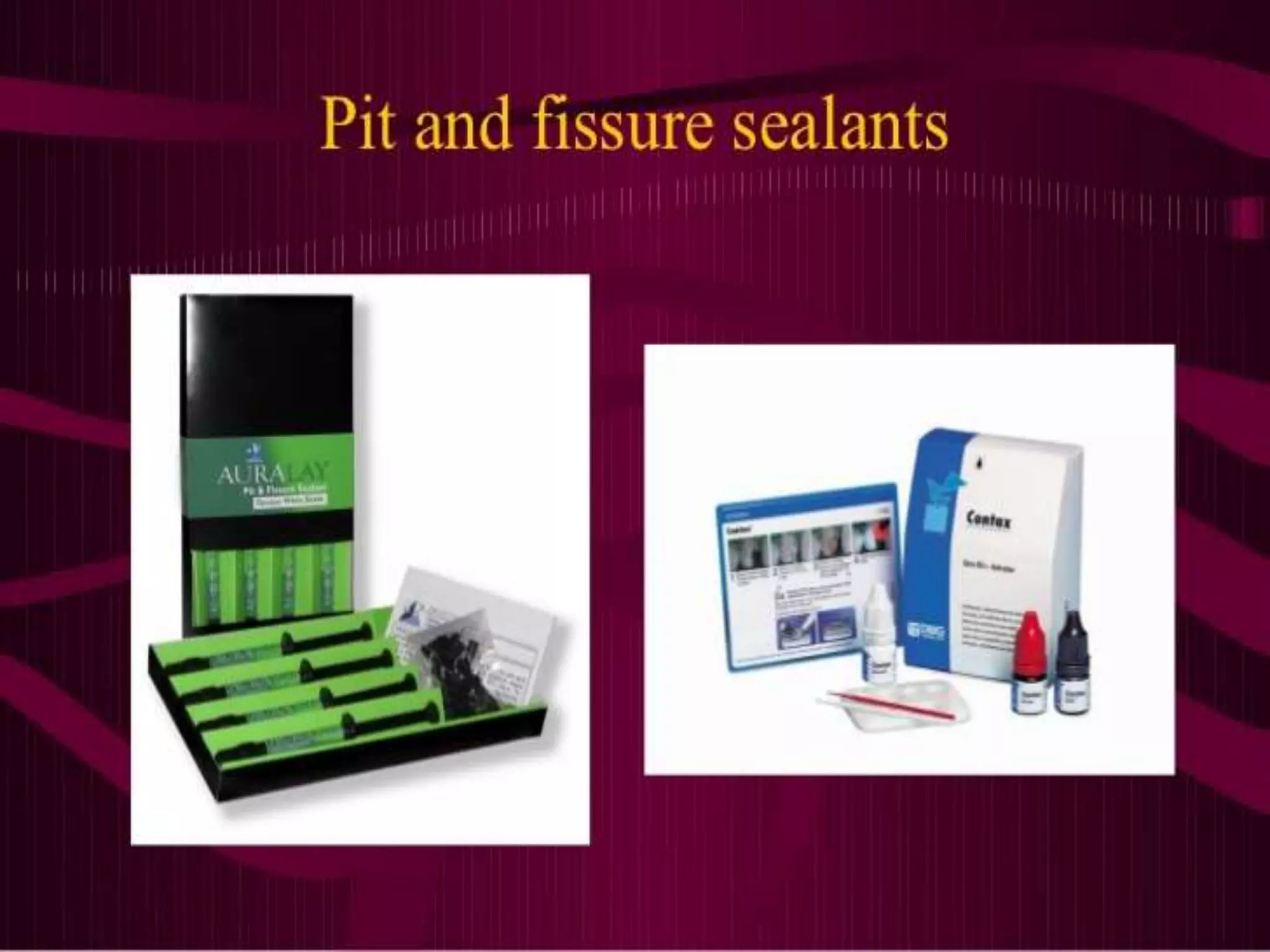 Pit and fissure sealants | PPTX