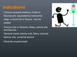 Pit and fissure sealants | PPTX