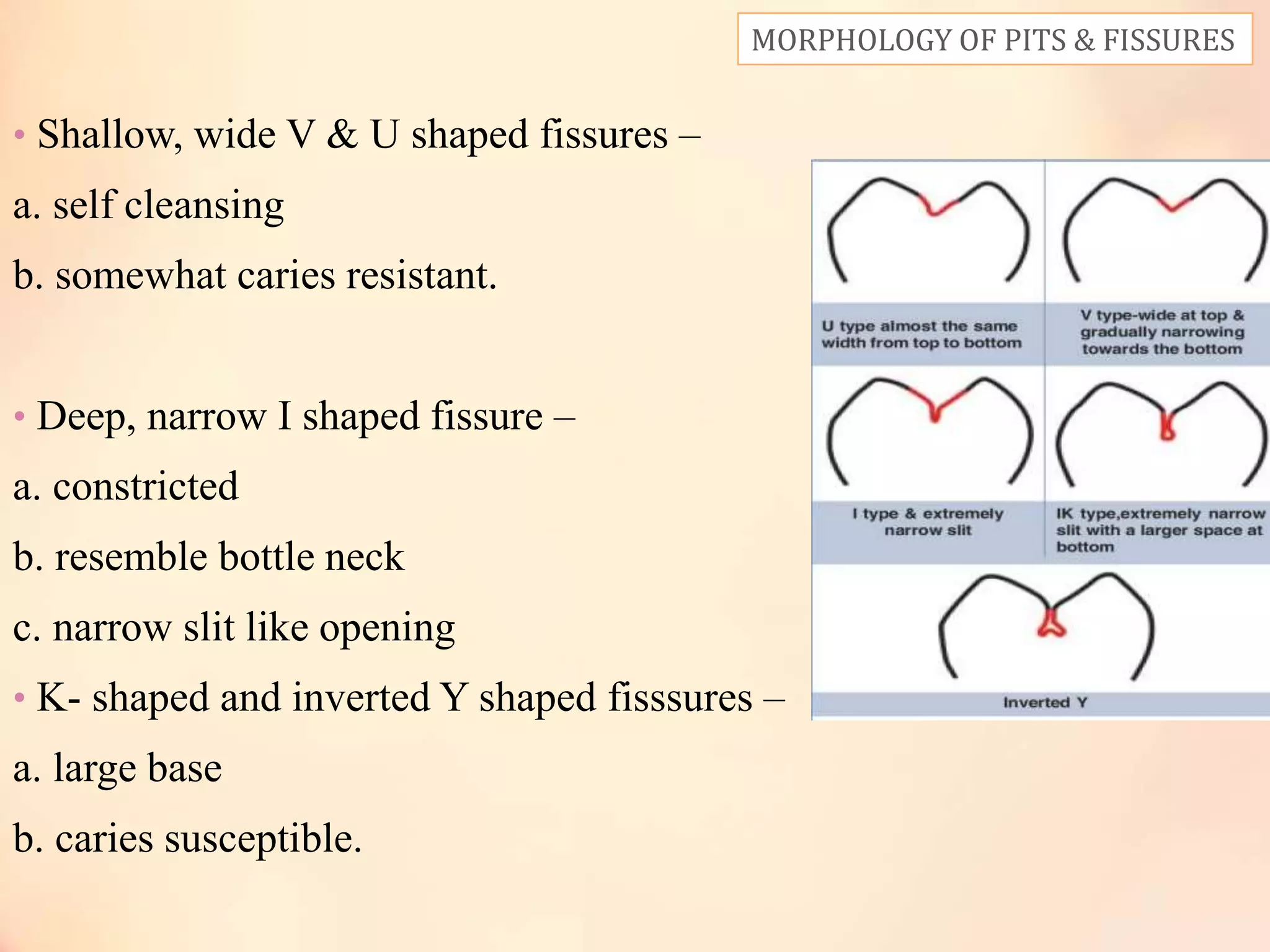 Pit and fissure sealants | PPTX